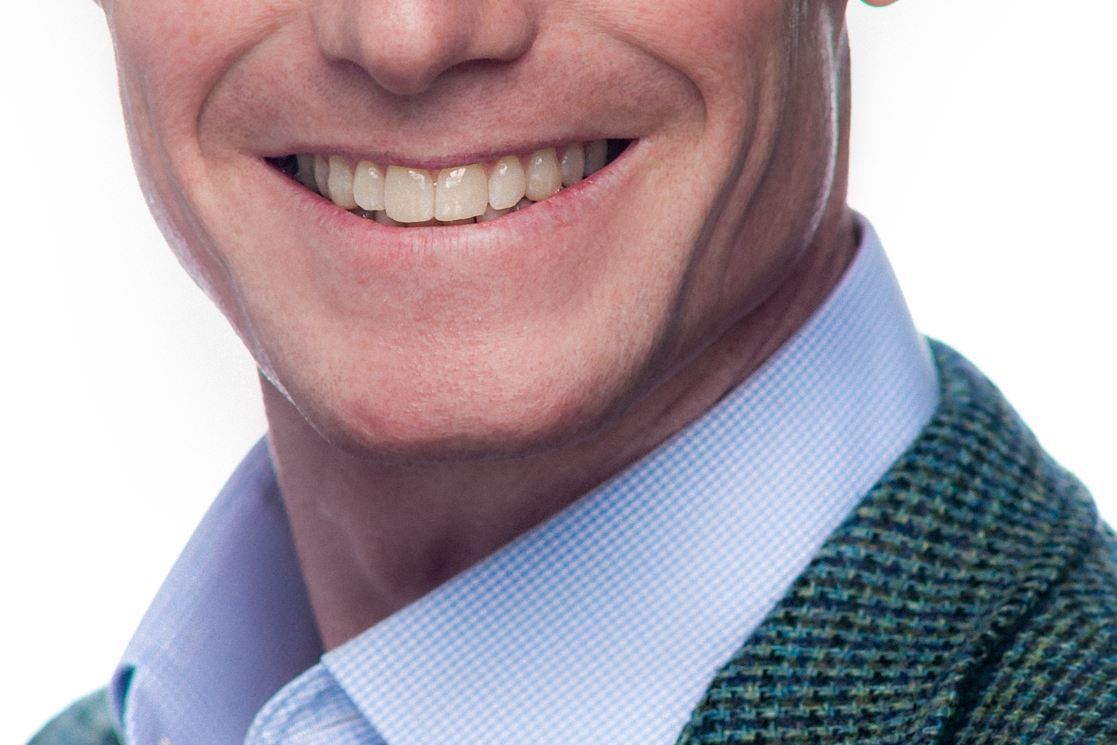 4 Ways To Retouch Skin Color In Photoshop We Should All Know