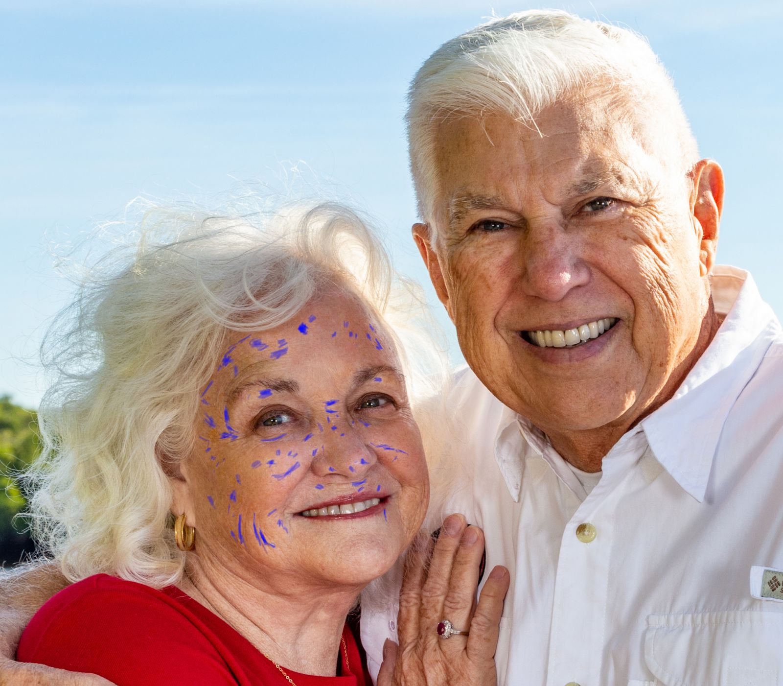 How To Cure Age Spots With The Dodge & Burn Reverse Time Machine!