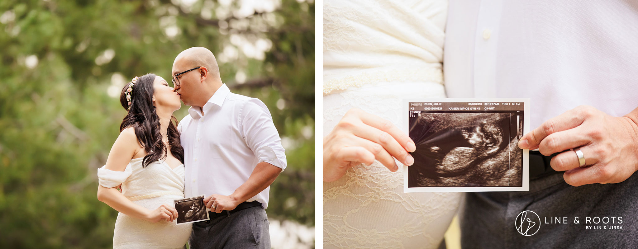15 Couple Maternity Photoshoot Ideas, Poses, and Tips